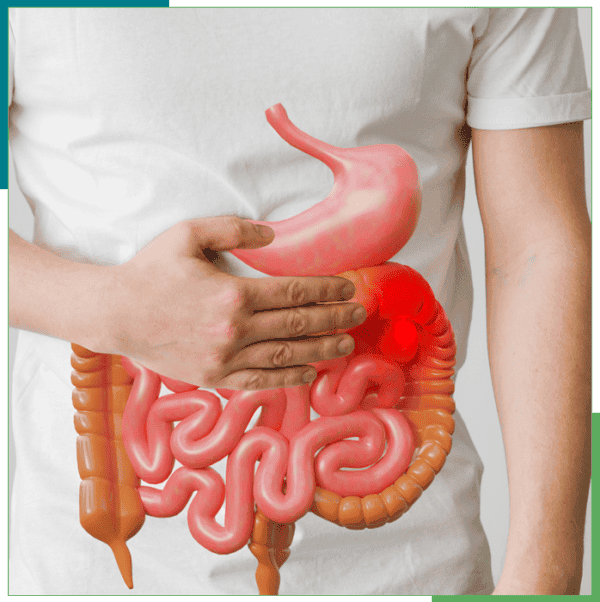 Best Reflux Ulcer Screening Checkup Packages in Hyderabad | Sri Sri ...